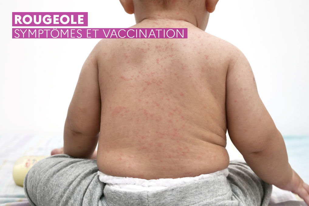 Rougeole : une seule protection, la vaccination | Agence régionale de ...